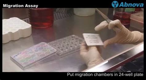 Transwell Migration Assay 细胞迁移实验操作教程 哔哩哔哩 Bilibili