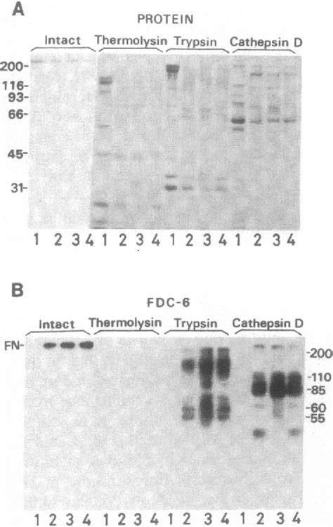 Figure 2 From The Oncofetal Domain Of Fibronectin Defined By Monoclonal Antibody Fdc 6 Its