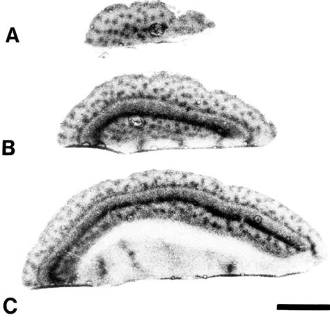 Figure 1 From Functional Anatomy Of Macaque Striate Cortex Iii Color