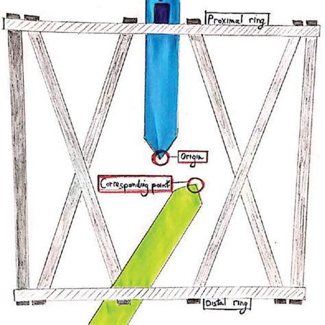 Pdf Clinical Utility Of The Taylor Spatial Frame For Limb Deformities