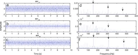 A B And C Faulty Vibration Signal Inner Race Fault Under