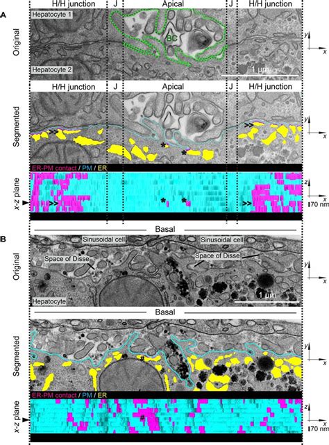 segmentation analysis of er pm contacts in em serial sections reveals