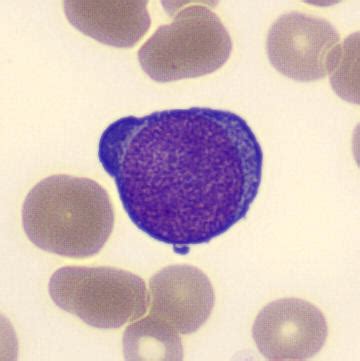 Eritroblasto basófilo CellWiki