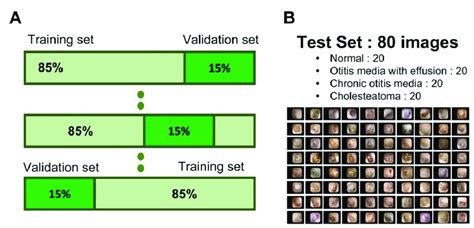 Training Validation And Test Set Data For Tympanic Membrane Images