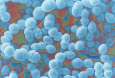 Streptococcus Faecium Bacteria Sem Stock Image B236 0133 Science Photo Library