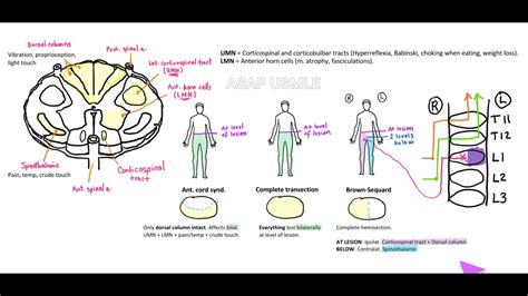 Spinothalamic Tract Physiopedia In 2021 Spinothalamic Tract Hot Sex