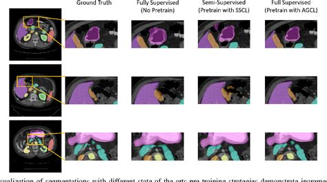 Figure 1 From Semantic Aware Contrastive Learning For Multi Object