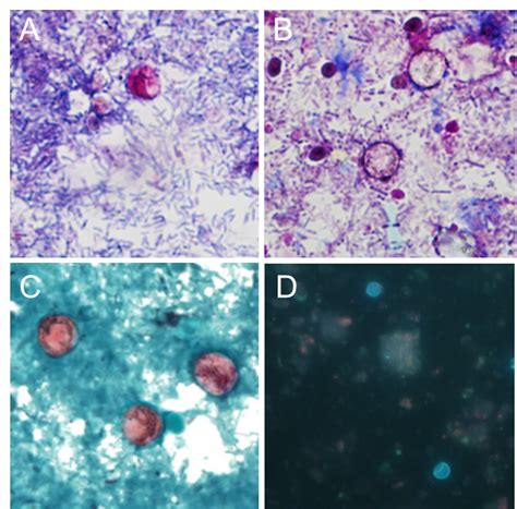 Cyclospora Detection And Reporting From Clinical Samples