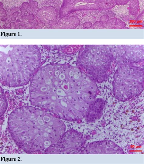 Figure 3 From Polypoid Cystitis In A Dog A Case Report Semantic Scholar