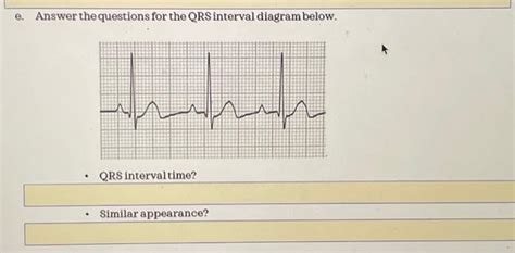 Solved E Answer The Questions For The Qrs Interval Diagram