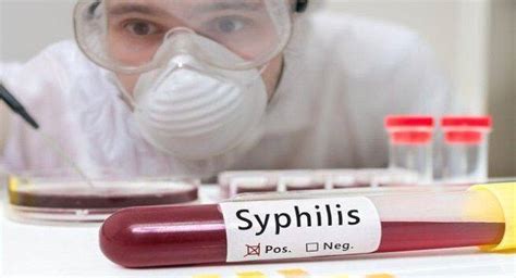 Things That Can Cause Penis Allergies After Having Sex TheHealthSite Com