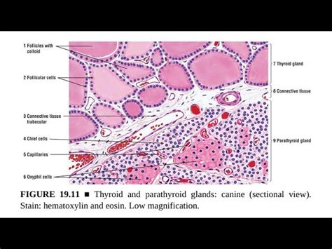 Thyroid Gland Slide Labeled