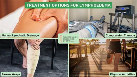 How Do You Treat Lymphedema Solutions And Treatment Options