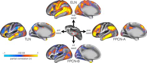 Unique Seed Based Functional Connectivity Patterns Associated With The