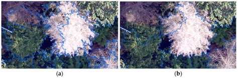 An Individual Tree Segmentation Method That Combines Lidar Data And