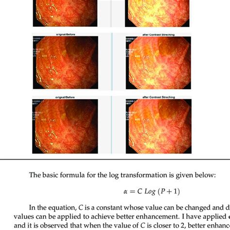 Results After Applying Log Transformation Download Scientific Diagram