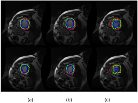 Visualization Results Of Fully And Semi Supervised Methods The Red