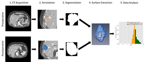 GitHub Rmsandu Segmentation Eval Extract And Evaluate Radiomics For