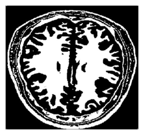 Visual Based Segmentation Accuracy Analysis Of Wm And Gm Regions A