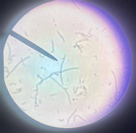 Solved Can You Please Help Me Figure Out This Bacteria I
