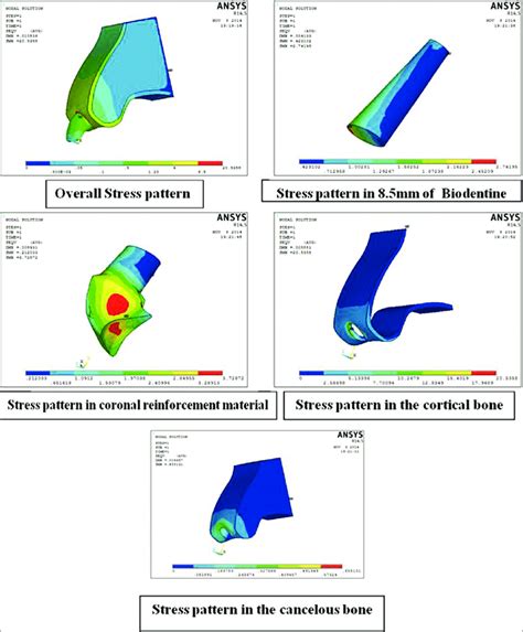Stress Analysis In Model 4 Download Scientific Diagram
