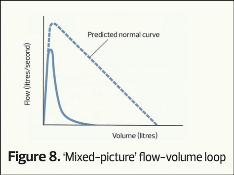 spirometry interpretation in the clinical situation
