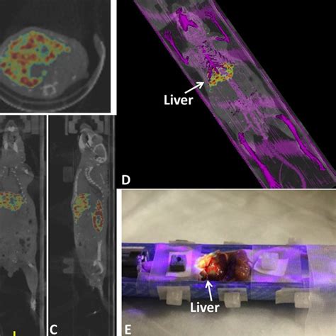 augmented reality guided procedure with the tumor bearing athymic cd 1