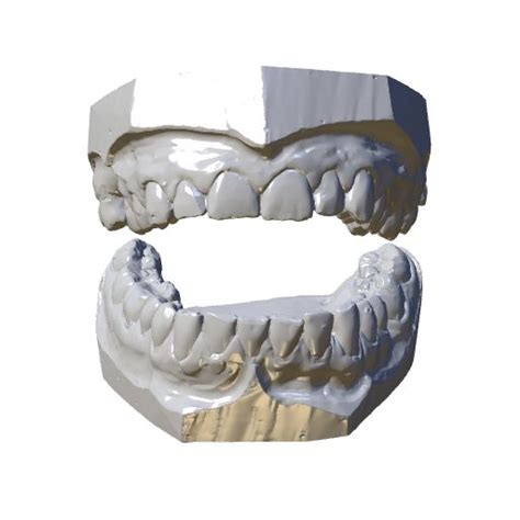 Teeth Scan
