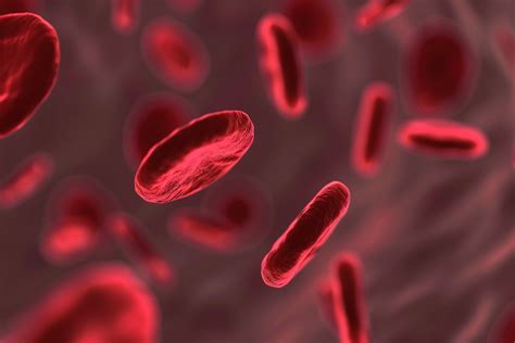 Megaloblastic Anemia Md Searchlight