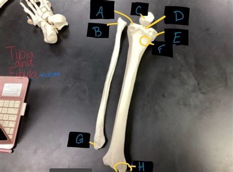 Lab Final Tibia And Fibula Flashcards Quizlet