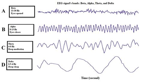 a novel multi class imbalanced eeg signals classification based on the