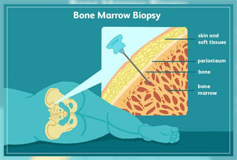 Biopsy Test Types Procedure And More Engiomed