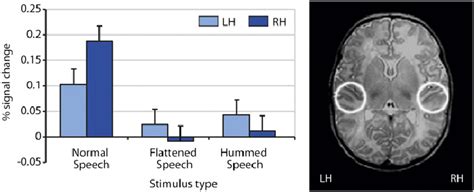 roi analysis including primary and secondary auditory cortex was