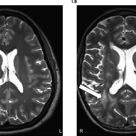exploratory regressions between frontal systems behavior scale scores