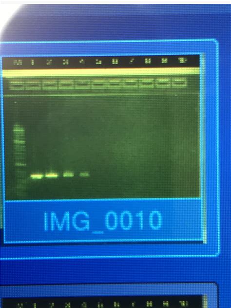 Solved What Size Was The Pcr Product How Did You Calculate