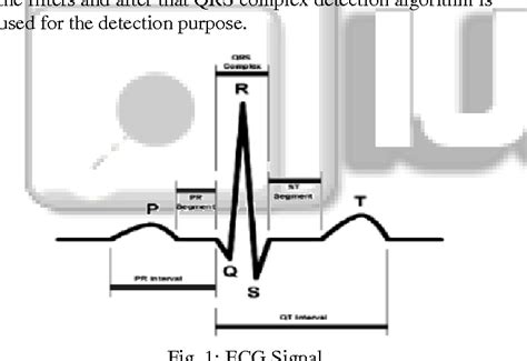 Figure 1 From Ecg Signal Processing And Detection Using Fir Filtering Semantic Scholar