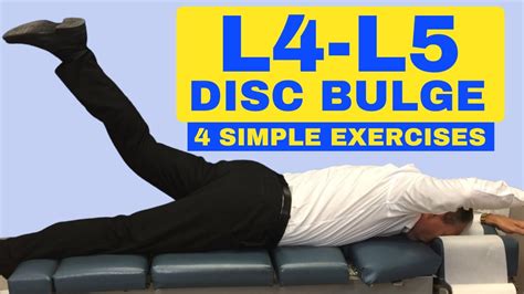 L L Disc Bulge Exercises Lumbar Radiculopathy Treatment OFF