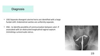 Congenital Anomalies Of Female Genital Tract Pptx