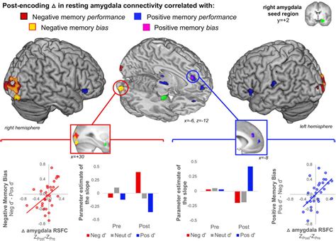 Post Encoding Enhancement Of Right Amygdala Connectivity And