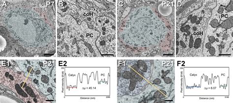 Mito APEX2 Labeling Visualized By SBF SEM At P7 A B And P21 C D Download Scientific