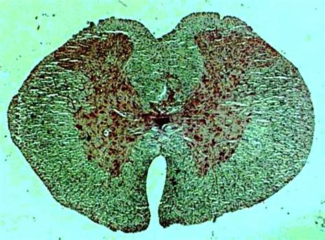 Matlab Remove Small Edges And Simplify An Histology Image Stack Overflow