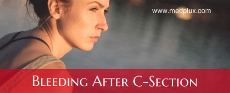 Bleeding After C Section How Long Will It Last 4 Danger Signs