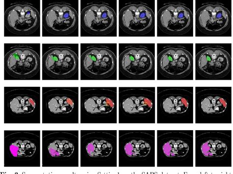 Figure 1 From Support Query Prototype Fusion Network For Few Shot Medical Image Segmentation
