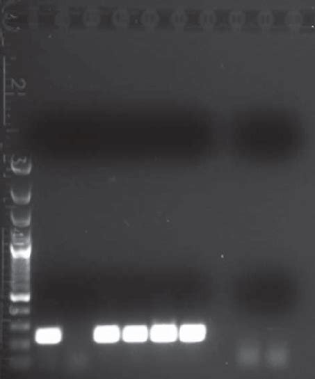 Detection Of Helicobacter Pylori With Nested Polymerase Chain Reaction