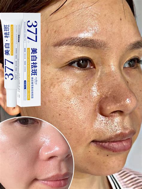 Рейтинг лучших кремов против пигментации на лице в аптеке — купить по низкой цене на Яндекс Маркете