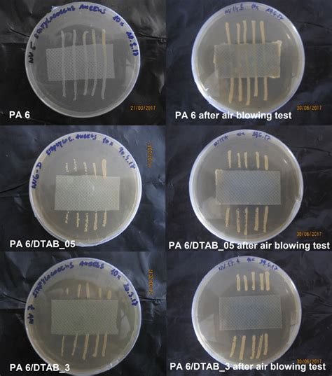 Results Of Antibacterial Tests Five Strips Of Staphylococcus Aureus Download Scientific