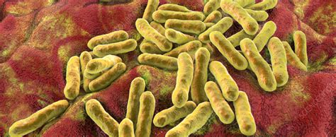 Benzoyl Peroxide Enhances Antibiotic Activity Against C Acnes