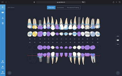 Periodontal Chart Online Derec Online Dental Charting