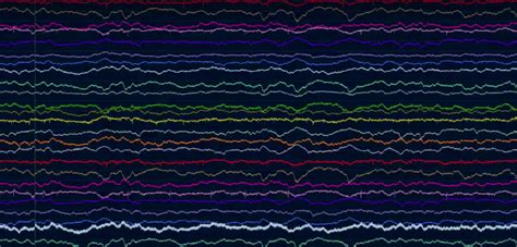 Elon Musk Thinks Neuralink Could Merge Humans With AI Neuroscience Says Wait