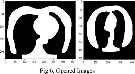 Figure 1 From Lung Cancer Detection Using Image Processing Techniques And Its Classification
